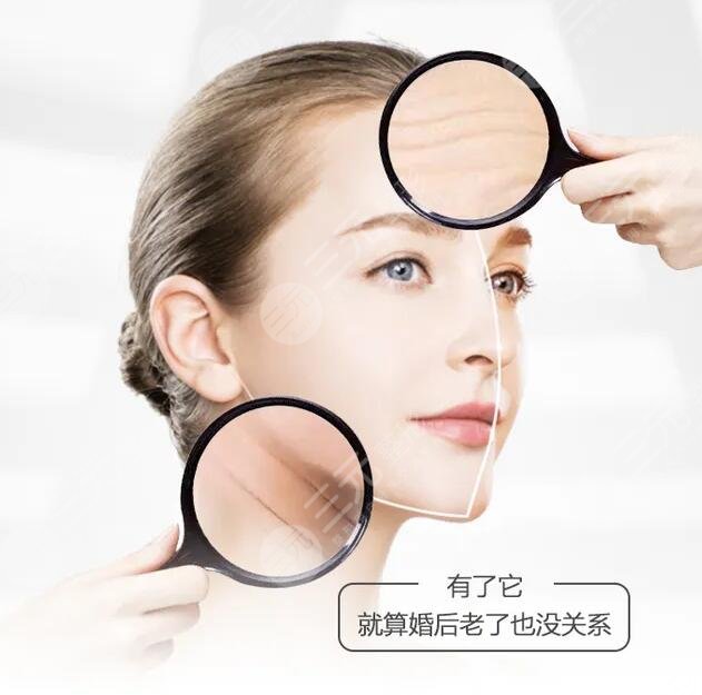 大拉皮手术能维持多久大概多少钱?拉皮手术果及注意事项解答! 城市惠整形
