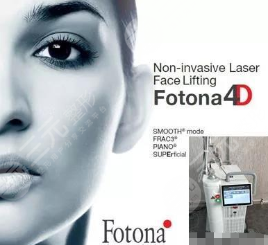 fotona4d欧洲之星原理超全科普，爆火的神奇之处在哪？-城市惠整形